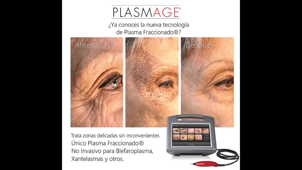 Acerca de la tecnología Plasmage | Cirugia Menor Punta Arenas